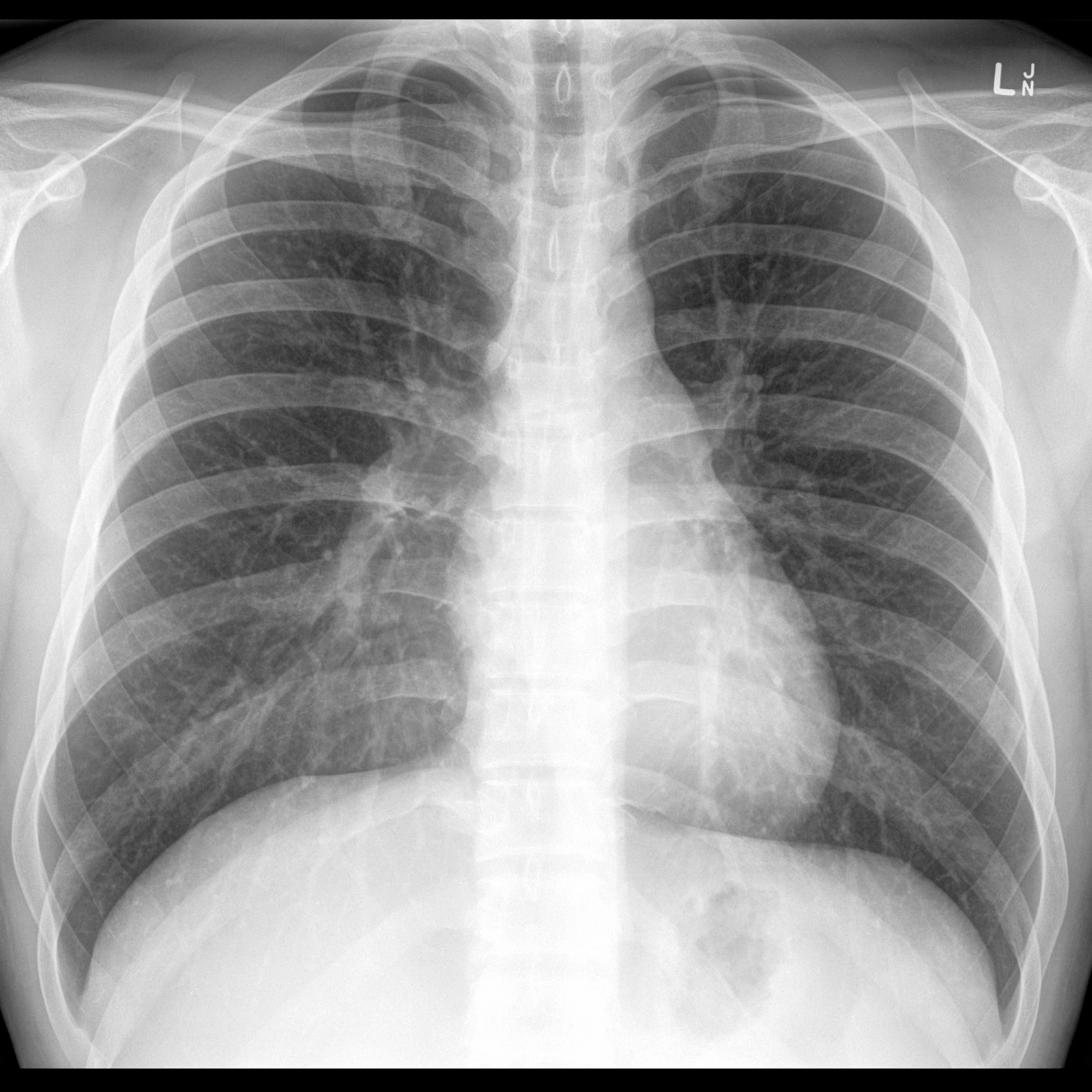 Medical imaging (Basic science review) – CoMo Science