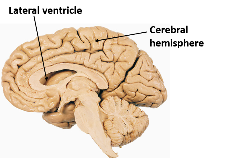 Ventr- – CoMo Science
