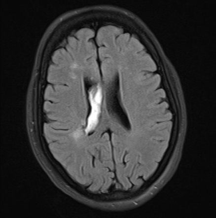 Ventr- – CoMo Science